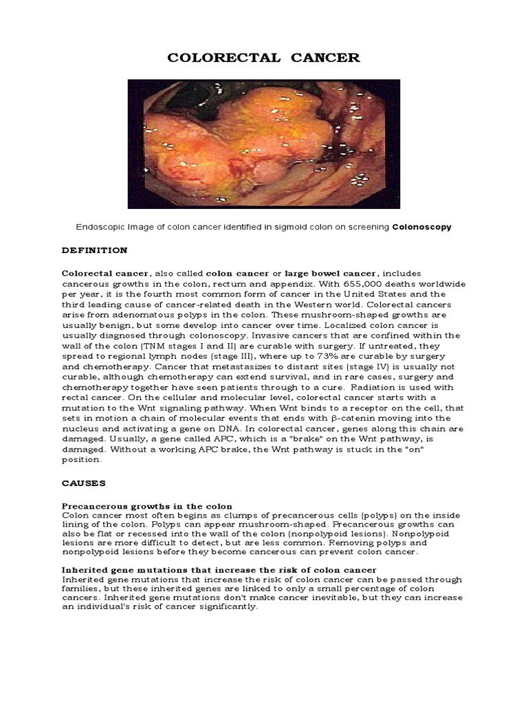 Colorectal Cancer: Colorectal Cancer, Also Called Colon Cancer or Large ...