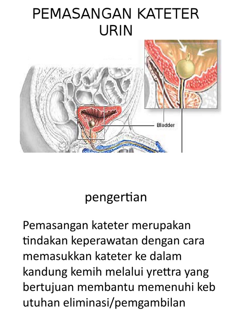 Panduan Lengkap Pemasangan Kateter Urin | PDF