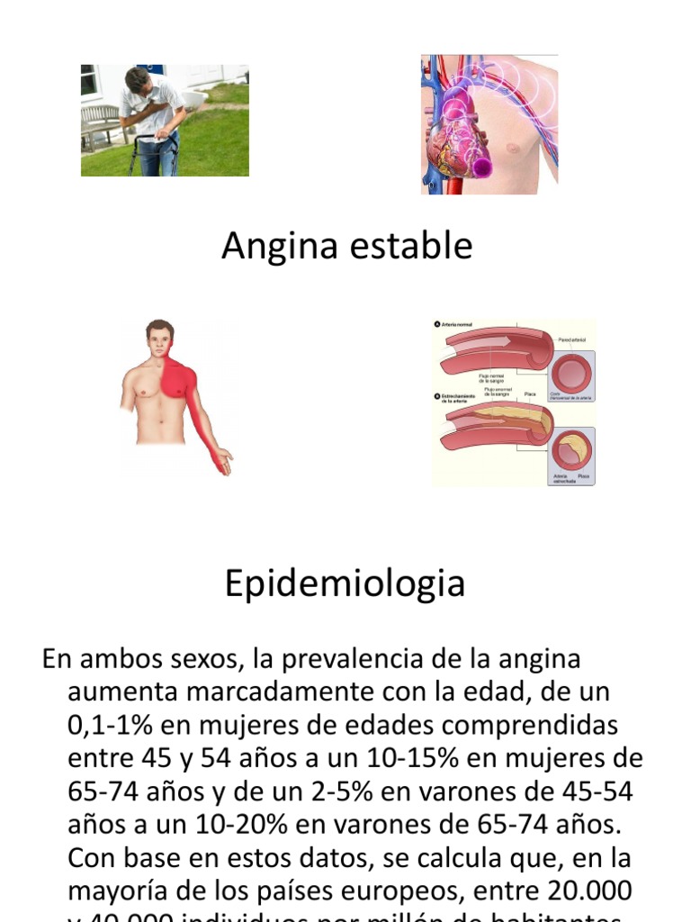Angina De Pecho Pdf 2024 : Angina de pecho // Middlesex Health – ETKTD