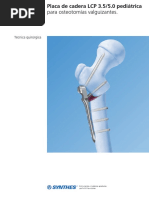 Endobutton CL Ultra TECNICA v2 | PDF | Extremidades (anatomía ...