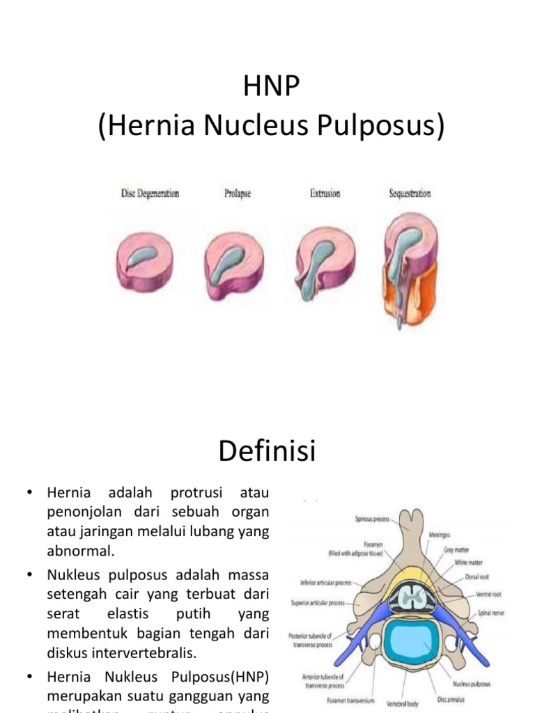 HNP_GEJALA | PDF