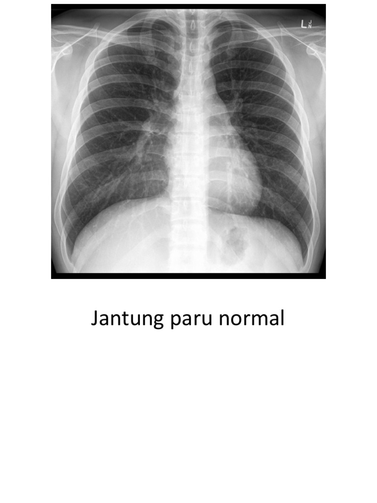 Ringkasan Radiologi Rongent | PDF