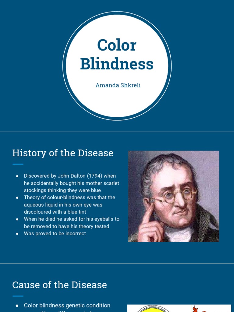 Color Blindness | PDF | Light | Vision