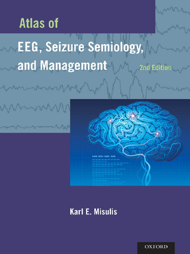 Atlas of EEG, Seizure Semiology, and Management 2nd Ed | Download Free ...