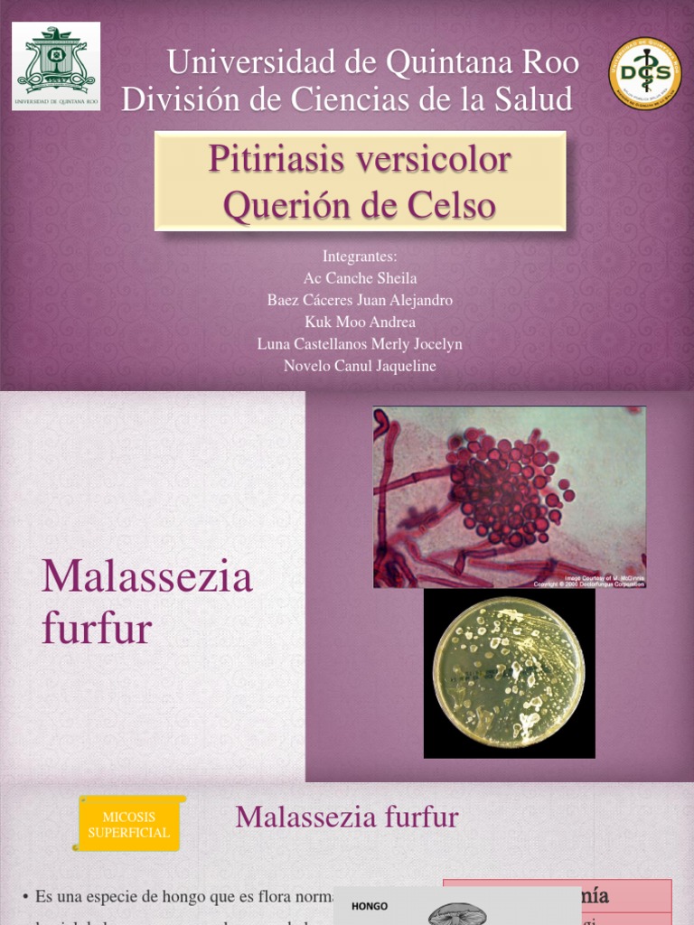 Pitiriasis Versicolor y Querion de Celso | PDF | Hongo | Bienestar