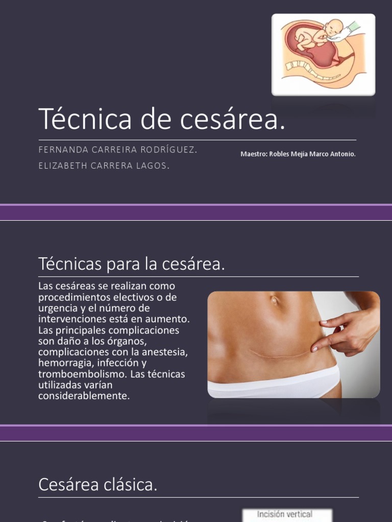 Técnicas de Cesárea: Pfannenstiel y Más | PDF | Seccion de cesárea ...