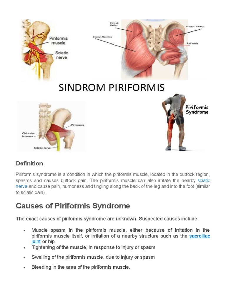 Piriformis