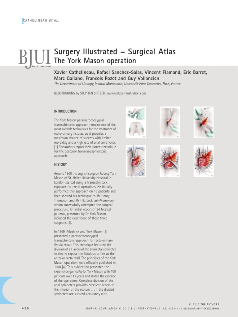 York Mason Procedure PDF | PDF | Rectum | Surgery