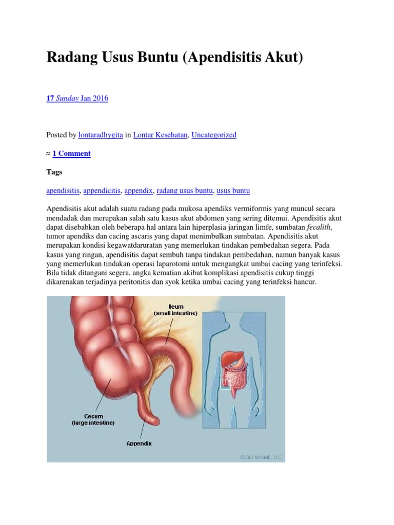 Radang Usus Buntu | PDF