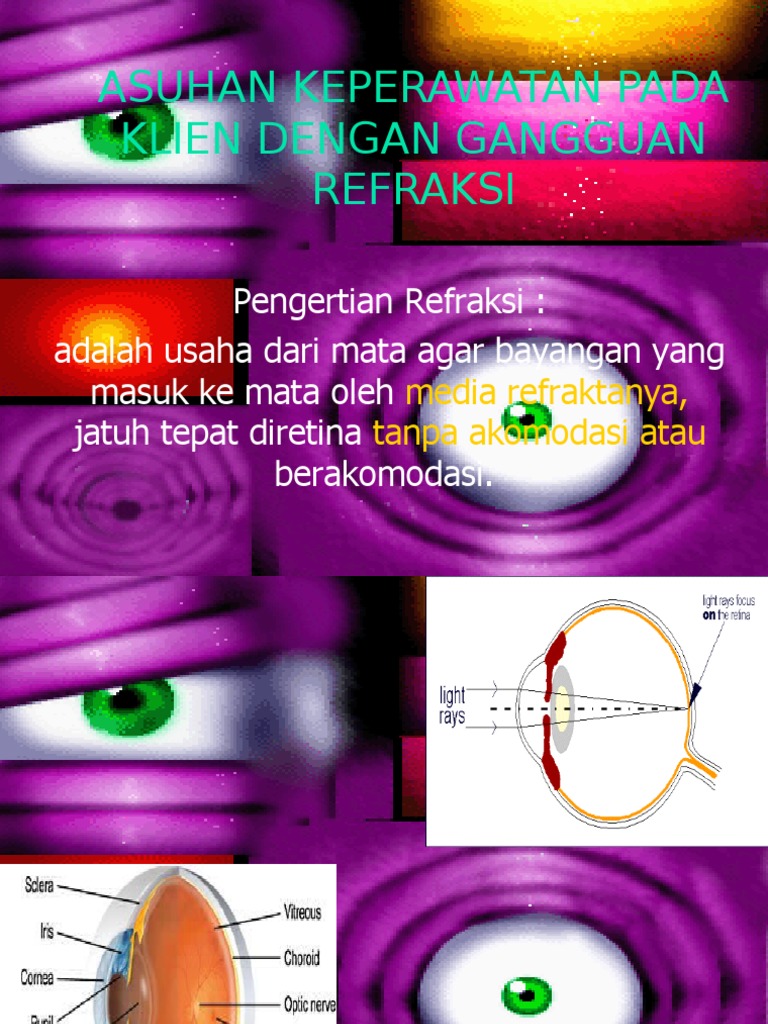 Asuhan Keperawatan Pada Klien Dengan Gangguan Refraksi | PDF | Lens ...