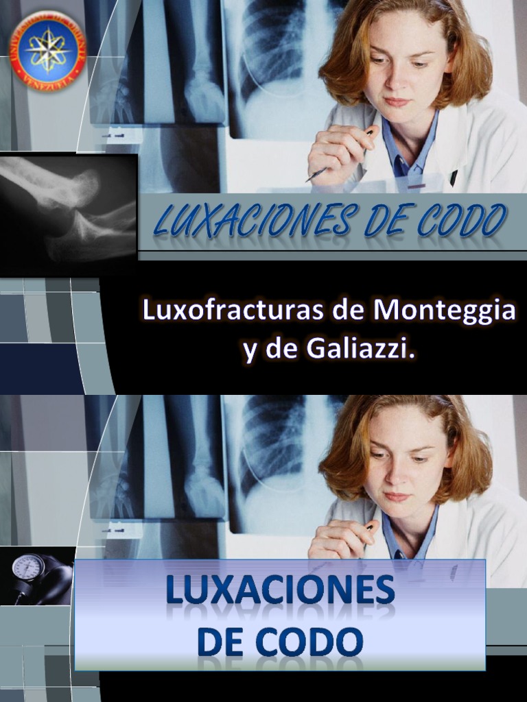 Luxaciones de Codo | PDF | Codo | Ciencia de la danza