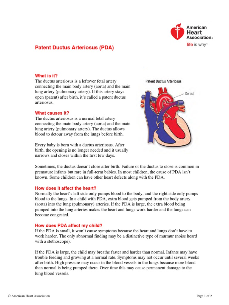 Patent Ductus Arteriosus (PDA) : What Is It? | PDF | Cardiovascular ...