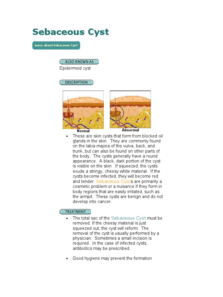 Sebaceous Cyst | PDF | Medical Specialties | Clinical Medicine