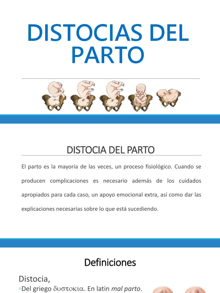 Distocias Del Parto | PDF | Parto | El embarazo