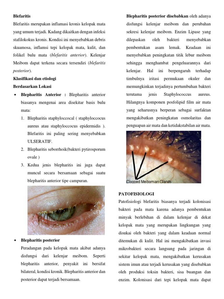 Blefaritis | PDF