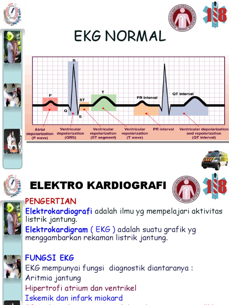 Chapter 17 EKG Normal | PDF