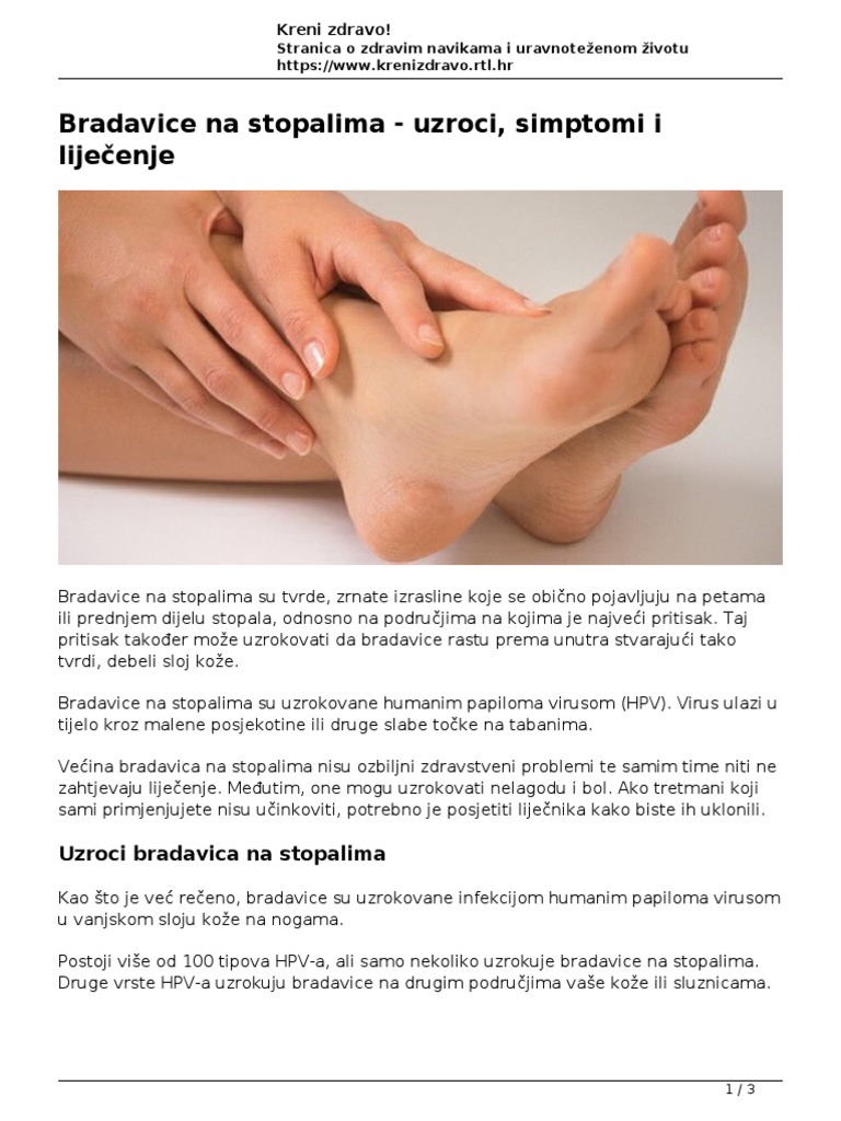 Bradavice Na Stopalima Uzroci Simptomi I Lijecenje PDF | PDF