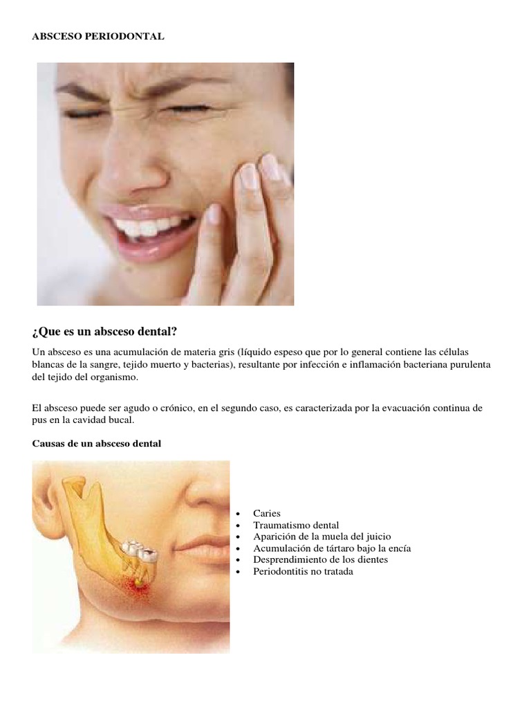 Tipos y tratamiento de abscesos dentales | PDF | Diente | Inmunología