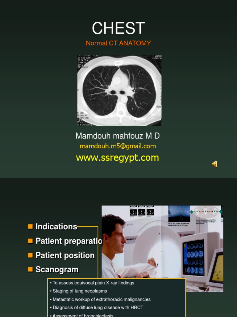 Normal CT Chest | PDF | Ct Scan | Diseases And Disorders