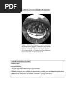 Escala Nomas | PDF | Infantes | Especialidades Medicas