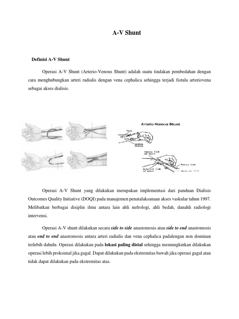 AV SHUNT Tugas Abg | PDF