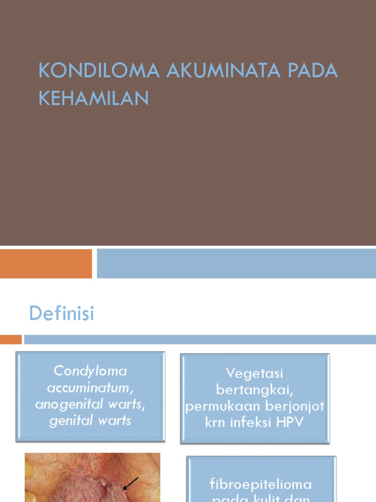 Kondiloma Akuminata | PDF