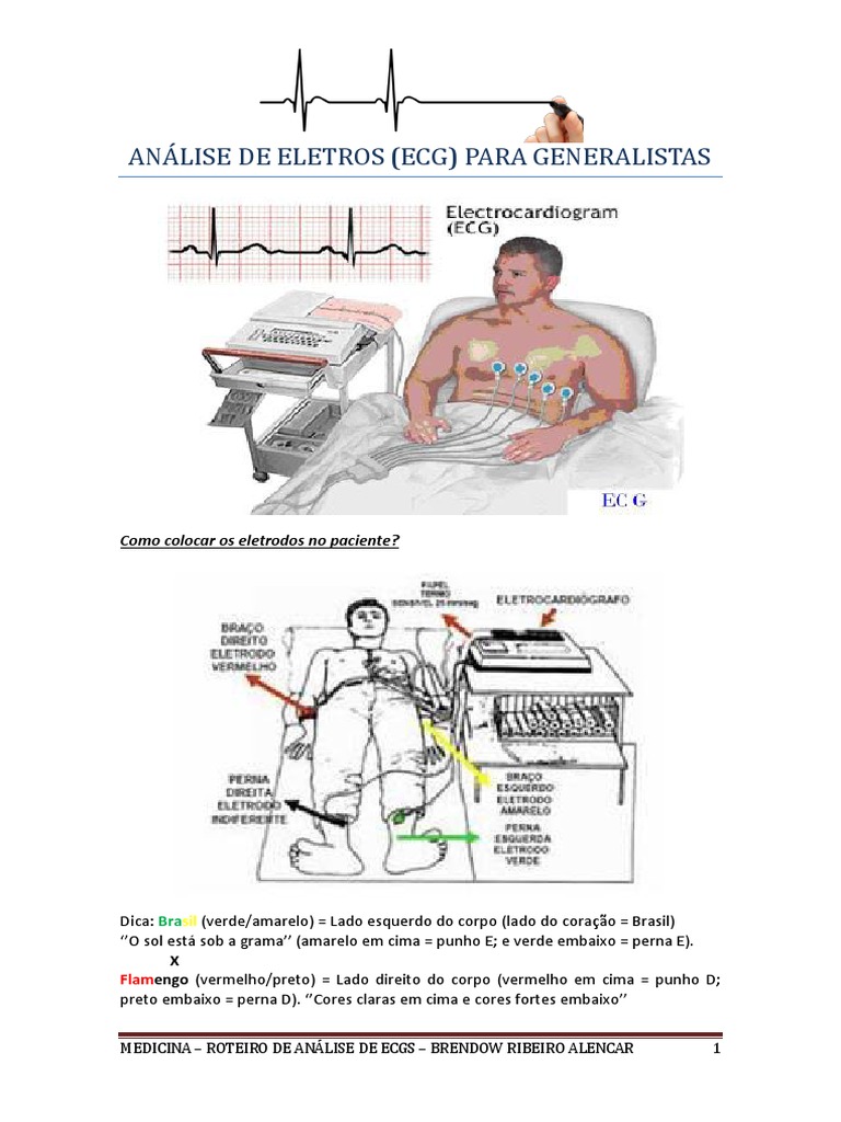 Ecg Passo A Passo | PDF | Eletrocardiografia | Infarto do Miocárdio