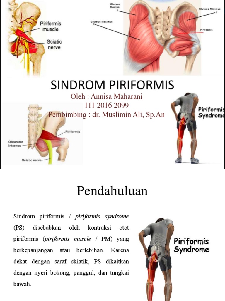 Piriformis Syndrome | Human Anatomy | Lower Limb Anatomy