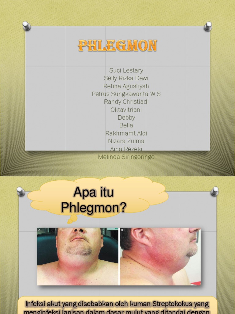 Phlegmon | PDF