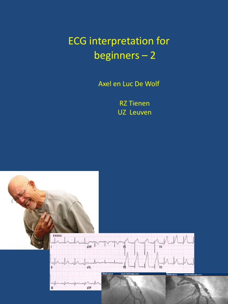 ECG Interpretation For Beginners Deel 1 | PDF | Electrocardiography ...