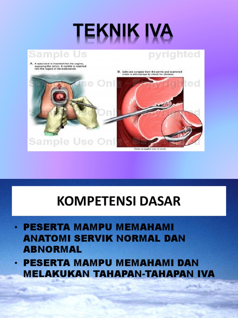 Teknik IVa | PDF
