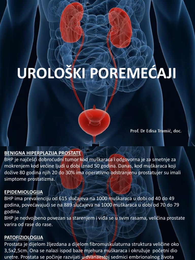 Uroloski Poremecaji | PDF