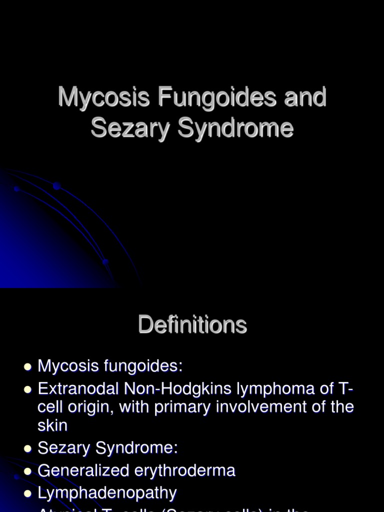 Epidemiology, Clinical Presentation, Staging, Histology, and Prognosis ...