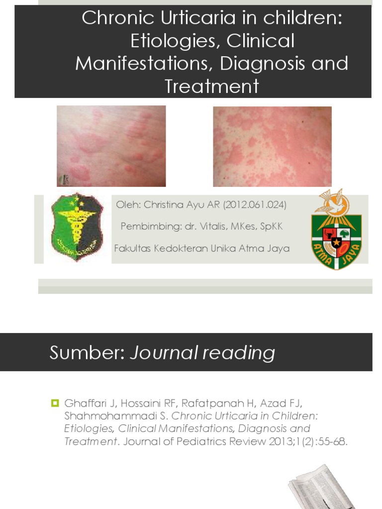 Chronic Urticaria in Children | PDF | Medical Specialties | Clinical ...