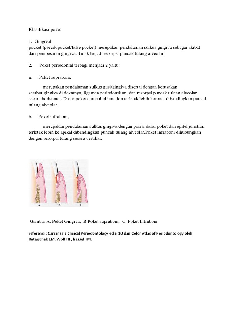 Klasifikasi Poket Periodontal | PDF | Ilmu Sosial | Kajian Bahasa Asing