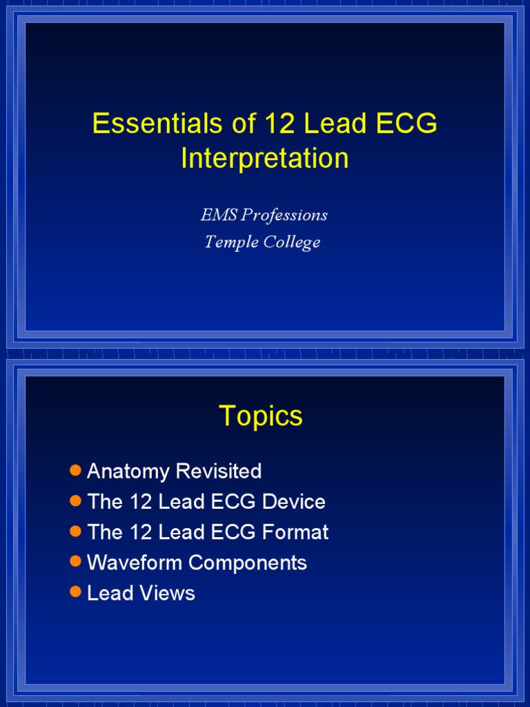 Essentials of 12 Lead ECG Interpretation: EMS Professions Temple ...
