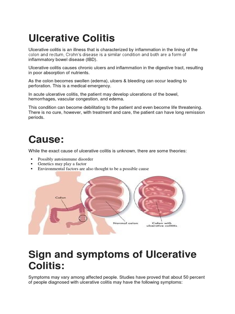 Ulcerative Colitis | PDF | Ulcerative Colitis | Inflammatory Bowel Disease