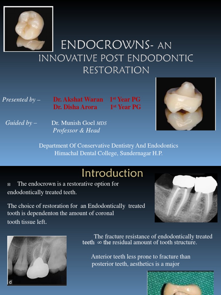 Endocrowns: Aesthetic Restoration for Teeth | PDF | Dentistry Branches ...