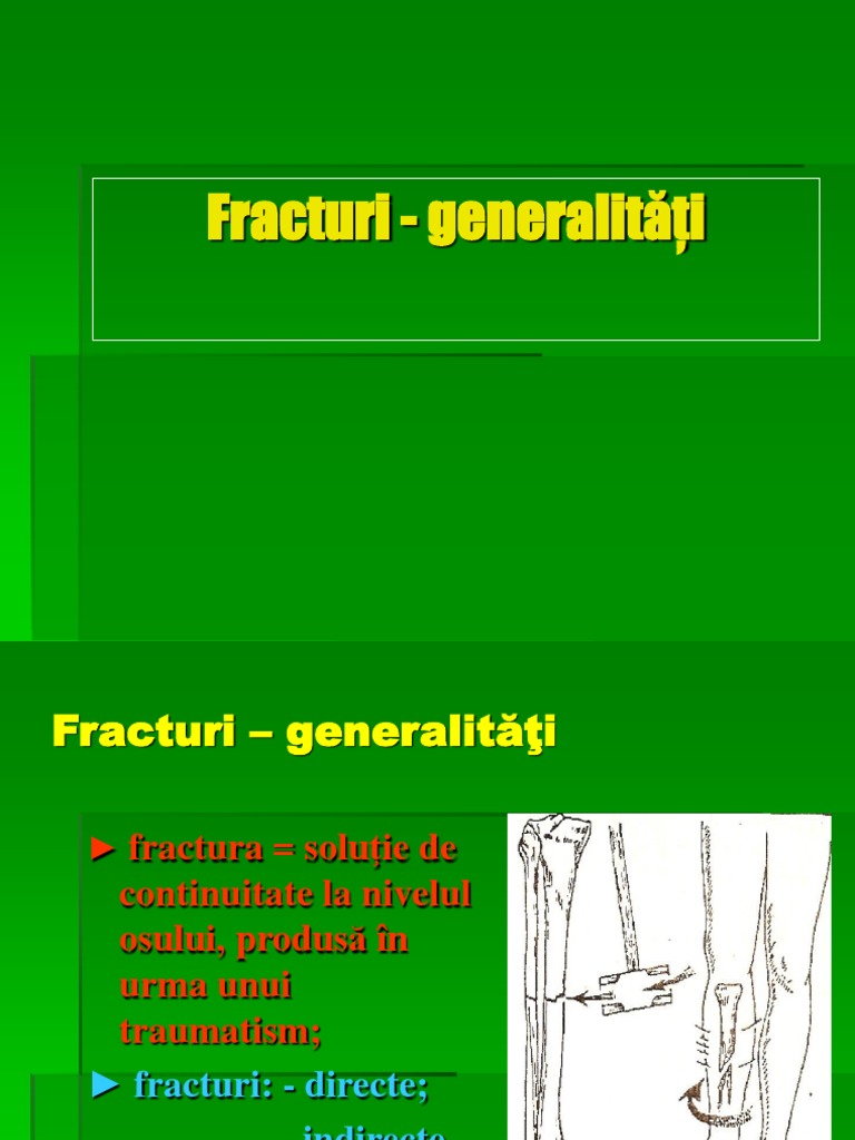 Fracturi | PDF