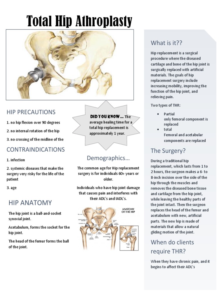 Total Hip Replacement Handout | Download Free PDF | Hip | Osteoarthritis