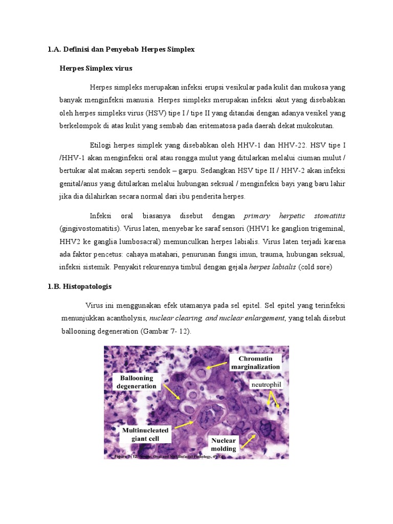 Herpes Simplex Dan Recurrent Intraoral Herpes Simplex Infection (RIH) | PDF