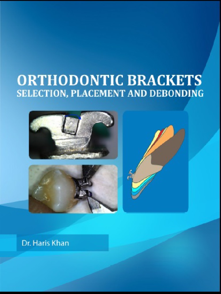 Orthodontic Bracket PDF | PDF | Titanium | Alloy