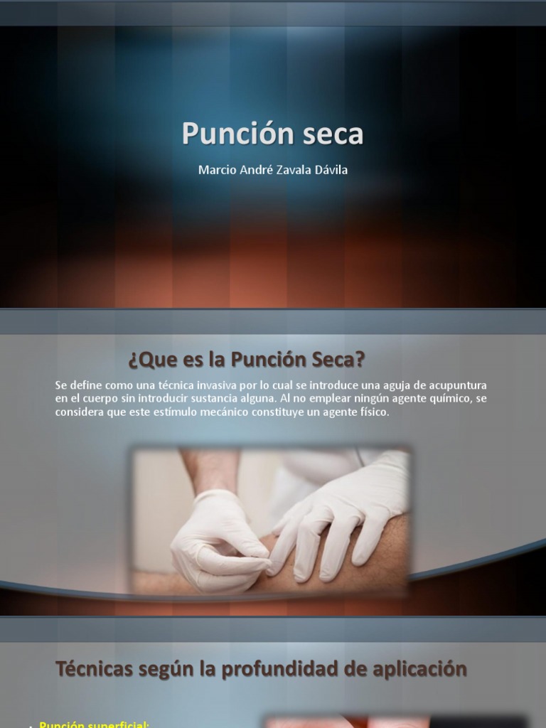Punción Seca | PDF | Dolor | Músculo