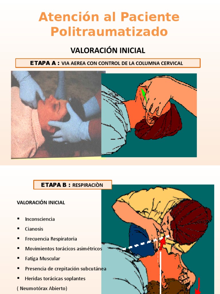 ATENCION INTEGRAL AL POLITRAUMATIZADO.pptx | Lesión | Enfermedades y ...