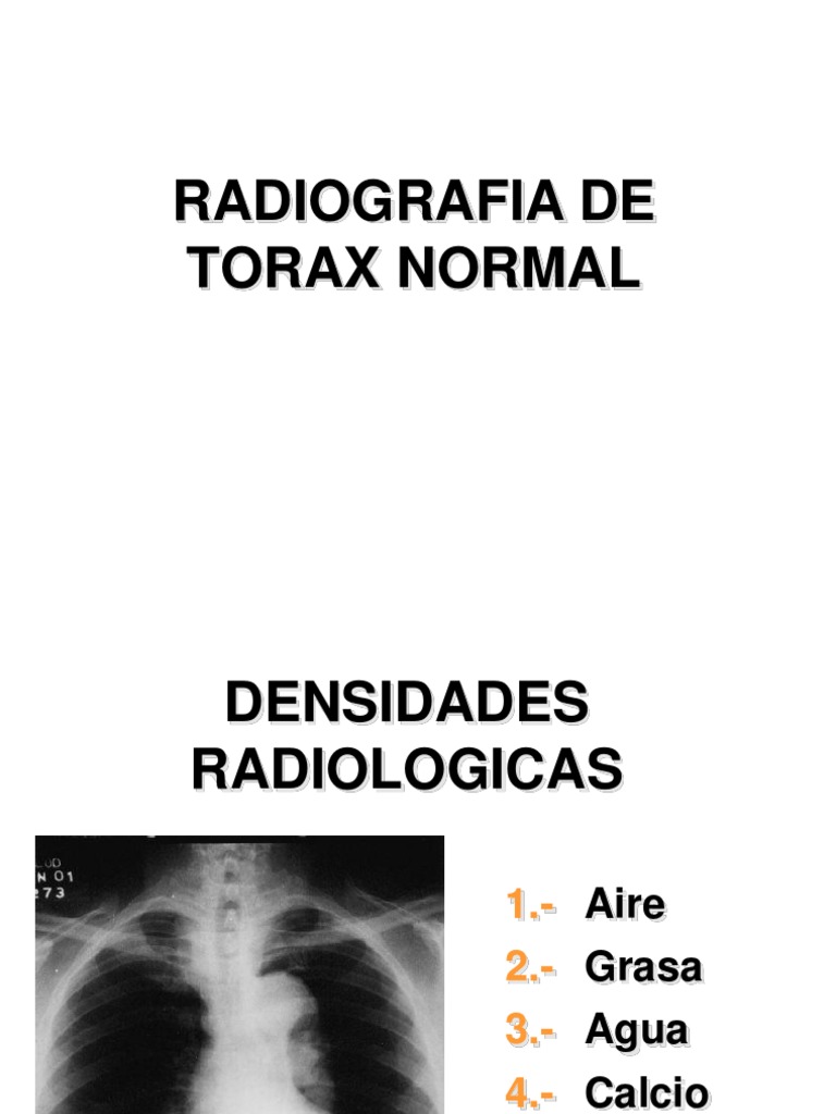 Rx. Normal de Torax | PDF | Pulmón | Tórax