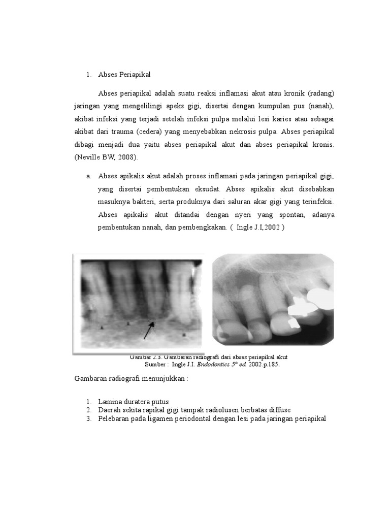Abses Periapikal: Penyebab & Gejala | PDF | Ilmu Sosial | Seni