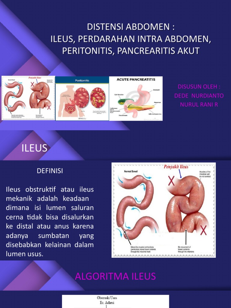 Gadar Distensi Abdomen | PDF