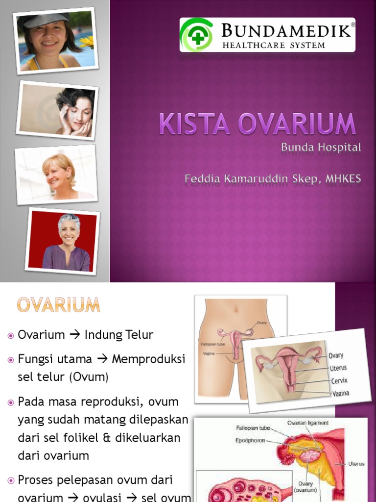 Makalah Kista Ovarium | PDF