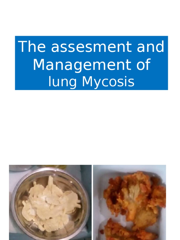 Lung Mycosis | PDF | Candida (Fungus) | Pneumonia