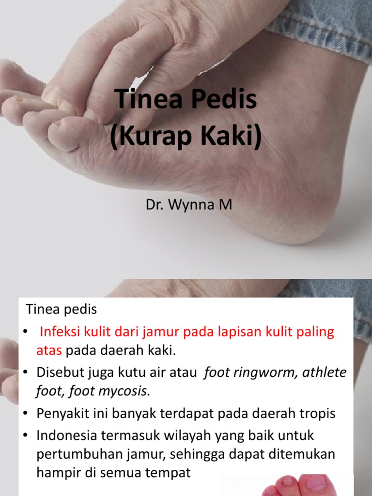 Tinea Pedis | PDF | Sains & Matematika